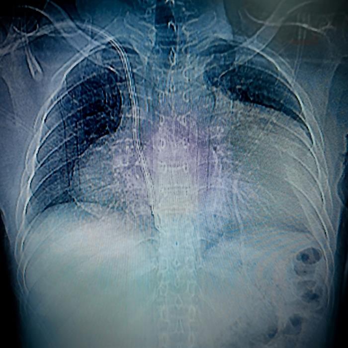 kullanıcı: radiography - ekşi sözlük